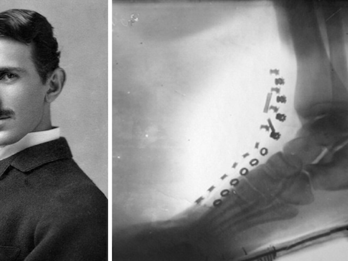 X Ray Nikola Tesla